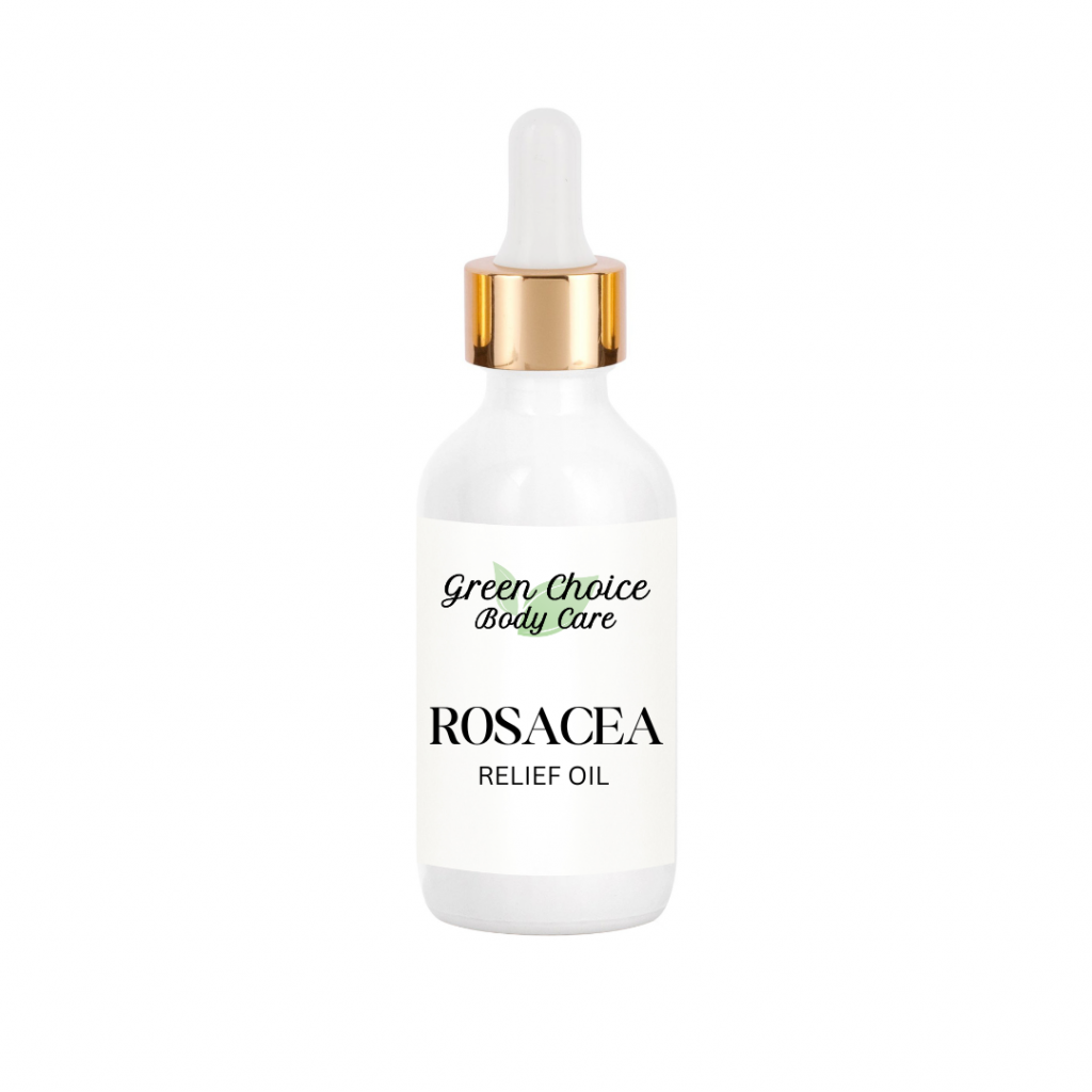 Rosacea Relief Oil 1 oz. – Green Choice Body Care