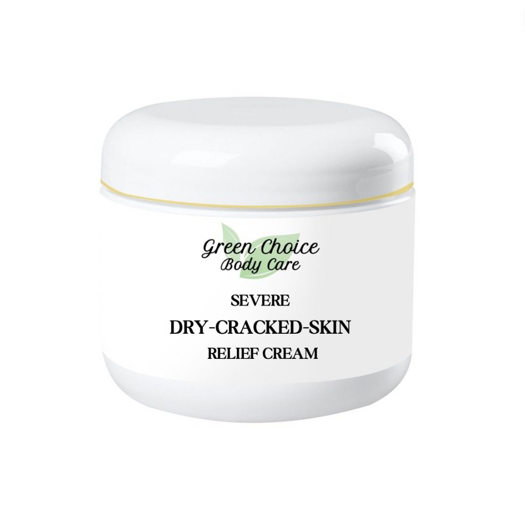 Severe Dry Cracked Skin Relief Cream – Green Choice Body Care