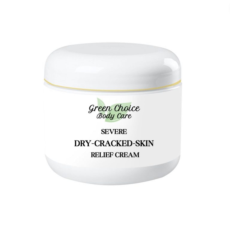 Severe Dry Cracked Skin Relief Cream – Green Choice Body Care